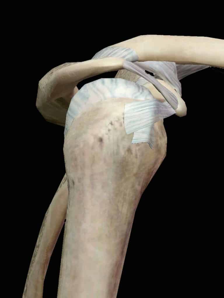 Σύνδρομο Υποκρωμιακής Προστριβής του Ώμου: Διάγνωση & Θεραπεία