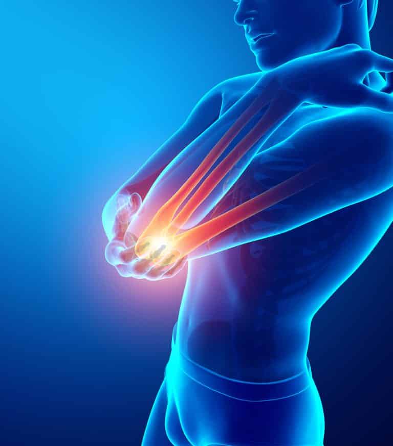 Επικονδυλίτιδα Αγκώνα: Ένα από τα συχνότερα σύνδρομα υπέρχρησης